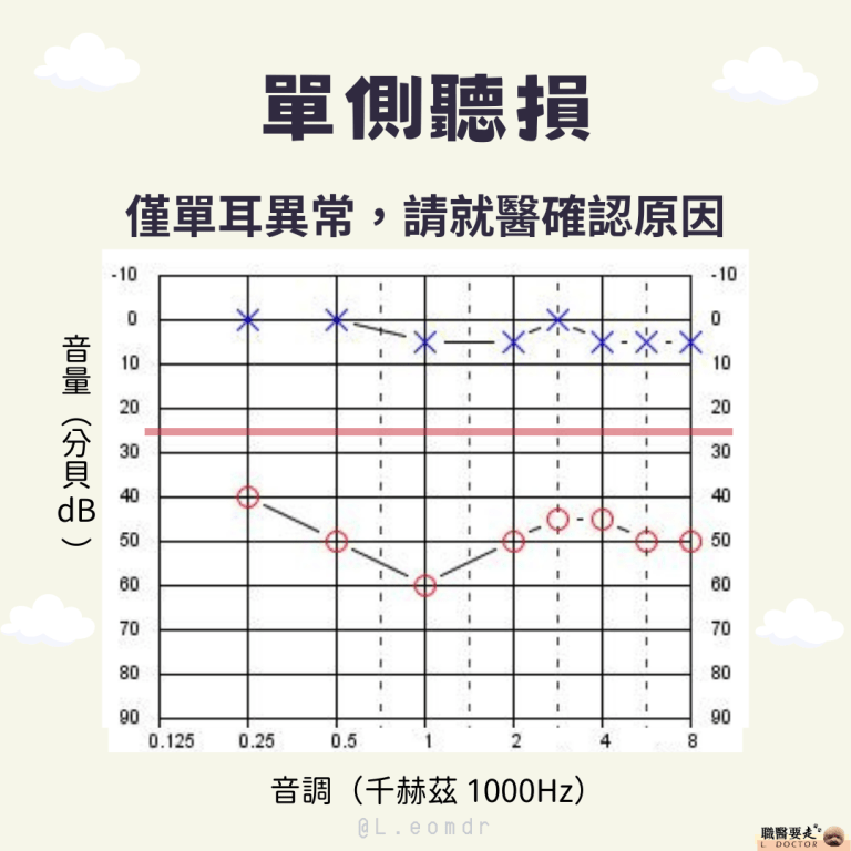 聽力圖判讀：基礎篇 – 職醫要走